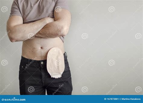 Vista Frontal Sobre O Saco De Colostomia Ligado Ao Doente Humano Tema