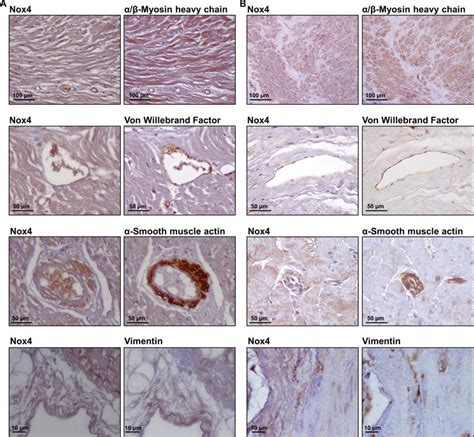 Co Expression Of Nox4 And Cell Type Markers Serial Immunohistochemical