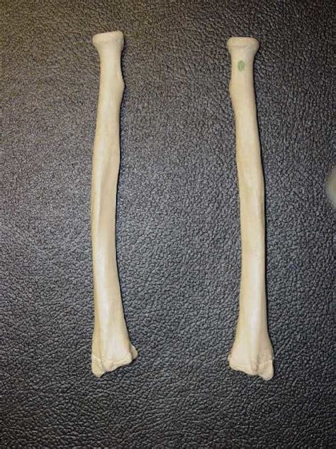 Anatomy And Physiology I Lab 2 Appendicular Skeleton Radius Diagram