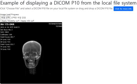 Github Nohsiondicomparser Cornerstone 오픈소스 라이브러리를 활용한 미니 웹 프로젝트 1 Beam Table 생성 2 Image
