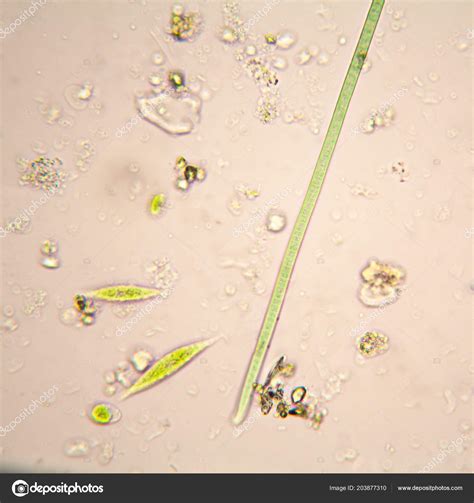 Microscopic Organisms Pond Water Oscillatoria Simplicissima Euglena