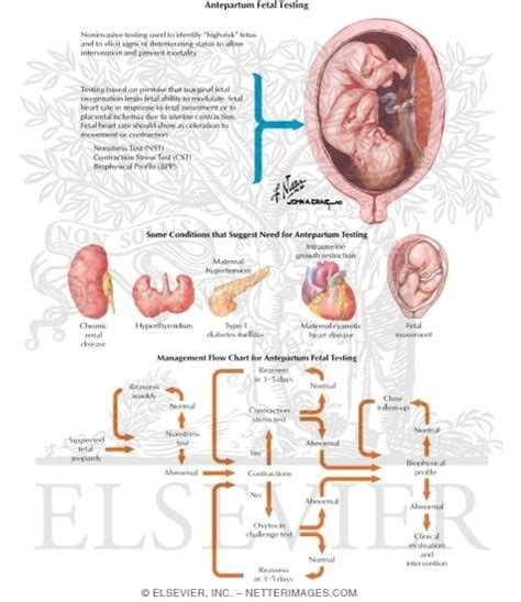 Antepartum Fetal Testing