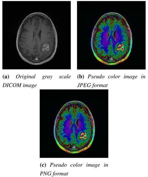 Original Dicom Image Figure 6a And Image With Double Cone Function