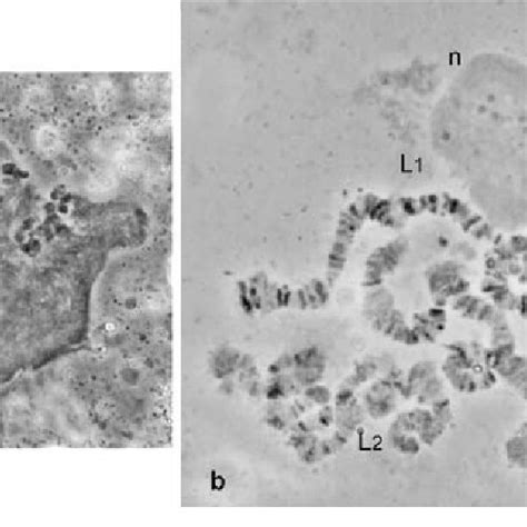 Comparison Of The Polytene Chromosome Maps Of The Xl Arm Glossina