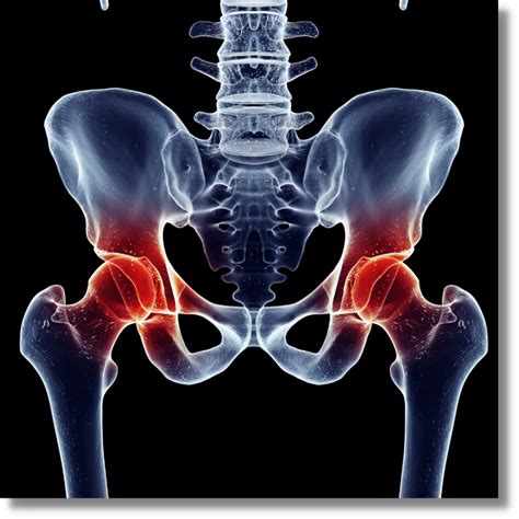 Know Some Muscle Energy Technique For Anterior And Posterior Ilium