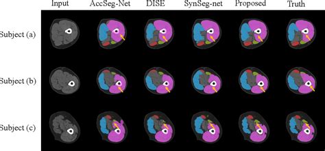 Single Slice Thigh Ct Muscle Group Segmentation With Domain Adaptation