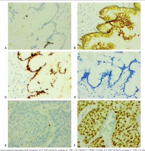 Figure 3 From A Rare Case Report Semantic Scholar