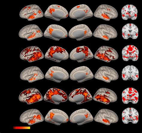 Univariate Whole Brain Analyses A Parametric Effects Of Liking