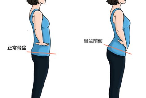 产后骨盆前倾图片自己大山谷图库