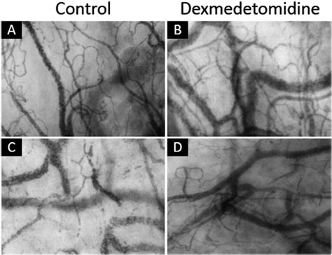 Sublingual Microcirculation Images At 2 H After Surgery A And B