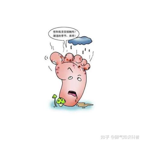 如何区分脚臭和脚气 知乎