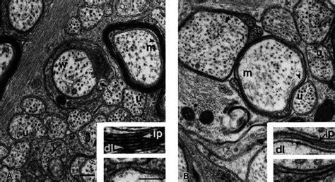 Ultrastructural Appearance Of Representative Axonal Profiles From Download Scientific Diagram