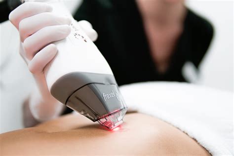 Fraxel® Dual Laser Treatment Manhattan Dermatology