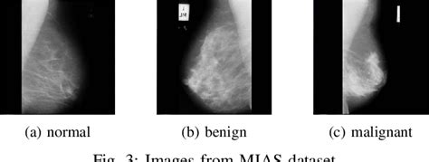 Figure 1 From The Impact Of Convolutional Neural Network Parameters In