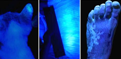 What Bacteria Glows Under Black Light