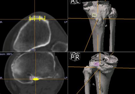 The Anteroposterior Axis Is Defined As The Line Connecting The Two Download Scientific Diagram