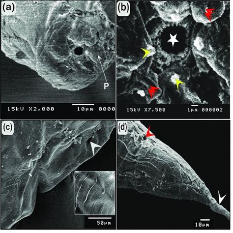 Female Body Of Ditylenchus Dipsaci Body Almost Straight When Relaxed