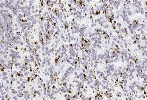 Ish And Rnascope® Image Analysis Services Oraclebio