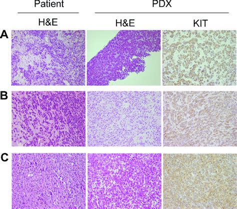 Immunohistochemical Ihc Analysis Of Original Patient Tumors And