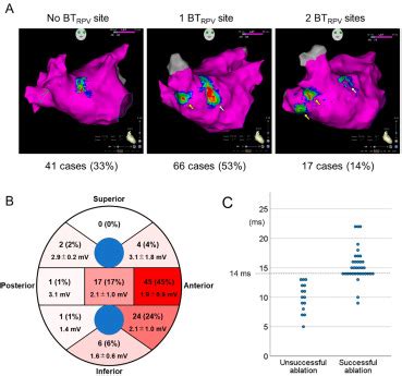 MP EFFECTIVENESS OF SYSTEMATIC ABLATION TARGETING EPICARDIAL CONNECTION SITES FOR