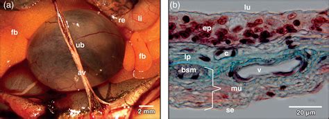 Microvascular Anatomy Of The Urinary Bladder In The Adult African