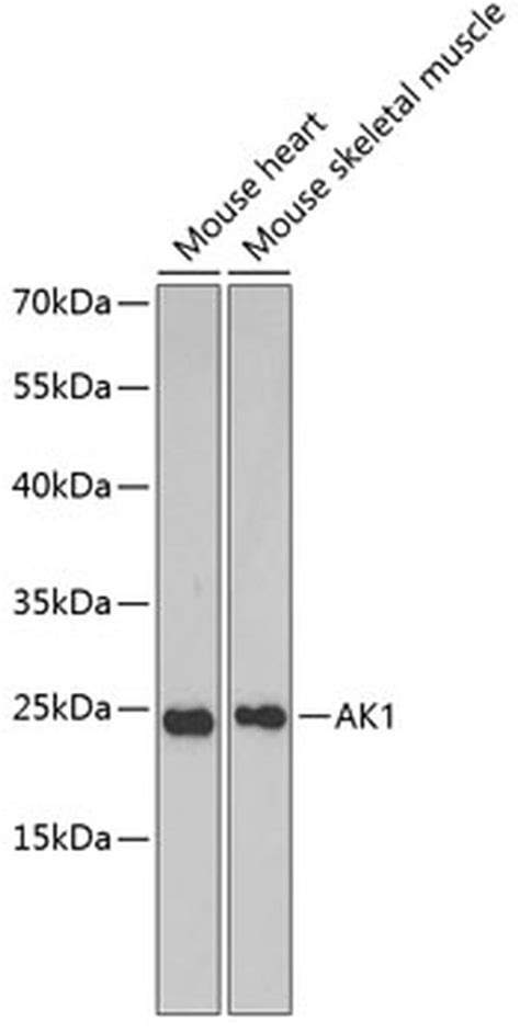 Adenylate Kinase 1 Polyclonal Antibody Pa5 89246