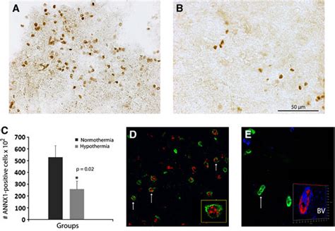 Phenotype And Function Of Annexin A1 Anxa1 In The Rat Brain After