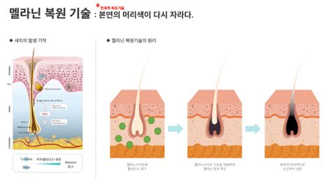 검은 머리카락이 다시 나도록 해주고 싶어요 Zdnet Korea