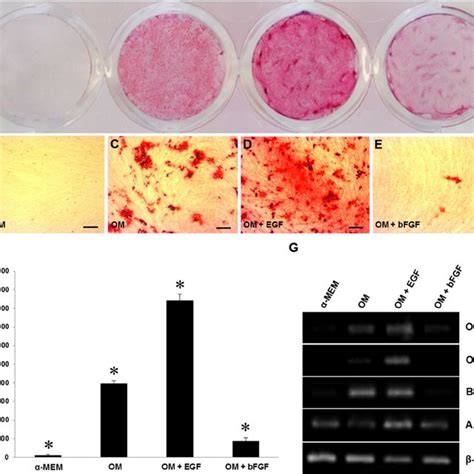 Mineralization And Gene Expression Of Osteoblast Markers A E Cells