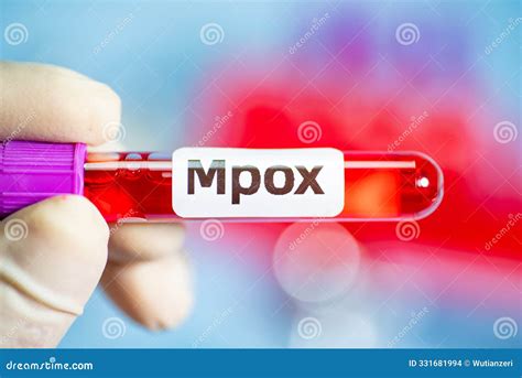 Blood Collection Tubes Mpox Test Positive Results WHO To Rename Monkeypox As Mpox Stock Photo