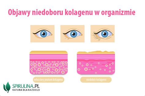 Objawy Niedoboru Kolagenu W Organizmie Algi Spirulina I Chlorella