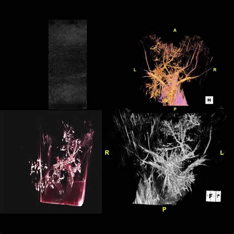 [video] Stanford 3d And Quantitative Imaging Laboratory On Linkedin