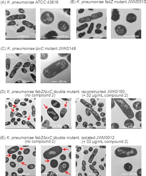 Klebsiella Pneumoniae Gram Stain Morphology