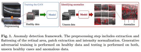 anogan unsupervised anomaly detection with generative adversarial