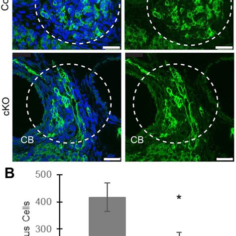 Glomus Cells In The Carotid Body Cb Require Elp1 For Normal