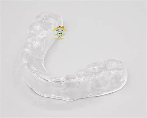 Occlusal Splint ผลิตโดย บริษัท บ้านฟันโคราช จำกัด