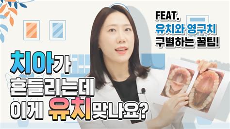 치아가흔들리는데이게유치맞나요 Feat 유치와 영구치 구별하는 꿀팁 Youtube