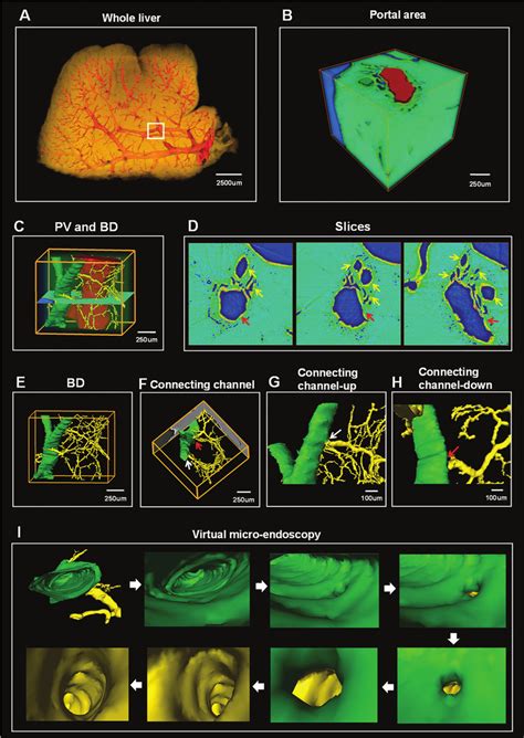 Three Dimensional 3d Visualization Of Interlobular Bile Ducts And