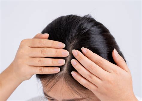 Does Your Hair And Scalp Need Sunscreen Too We Checked In With A Dermatologist To Find Out