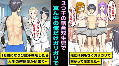 【漫画】体が繋がった状態で生まれた3つ子の俺たち。真ん中の俺だけ腕がなくて両端の姉と妹に栄養を奪われてガリガリのまま16歳になったが分離手術に