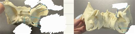 Biol 251 Practical Sphenoid Bone Diagram Quizlet