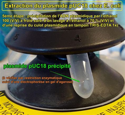 Extraction Restriction Linéarisation Du Plasmide Puc18