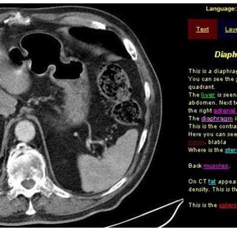 User Site The Annotations Are Automatically Cross Linked To The Text Download Scientific