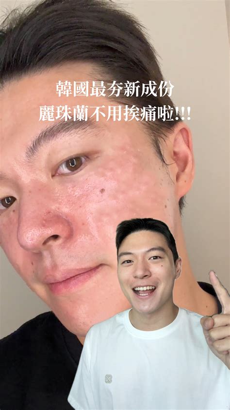 阿侖 Alun 超多人來韓國必打的麗珠蘭 現在不用挨針 也可以把麗珠蘭的最好成分pdrn 直接擦上讓皮膚做吸收 就是這罐cnp專業全效逆齡