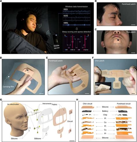 At Home Sleep Monitoring Patches For Assessing Sleep Quality And Sleep