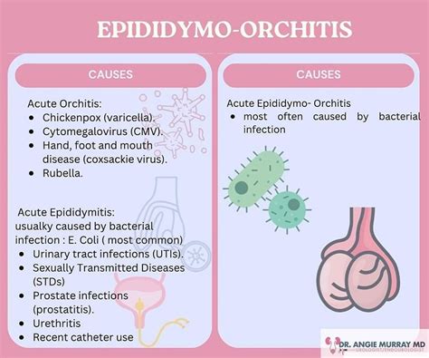 🔹epididymo Orchitis Is An Inflammation Of The Epididymis And Testes 🦠it Is Normally Caused By