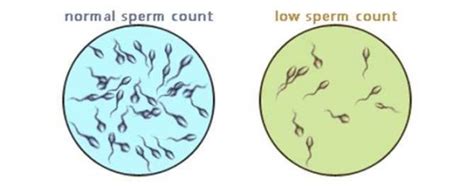 Reasons For Low Sperm Count In Men Best IVF Treatment Trivandrum