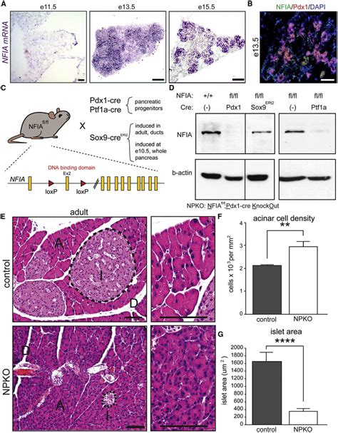Nfia Expression Maintains Pancreatic Cell Composition A Rna In Situ Download Scientific