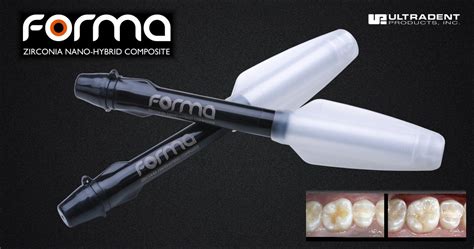 Mimicking Nature With A One Step Body Shade Composite