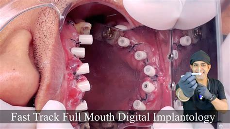 Dr Rajat Sachdeva Posted On Linkedin